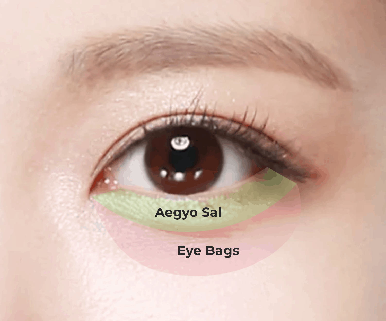 Collection 92 Pictures Pictures Of Eye Bags Superb 10 2023 Collection 92 Pictures Pictures Of Eye Bags Superb 10 2023