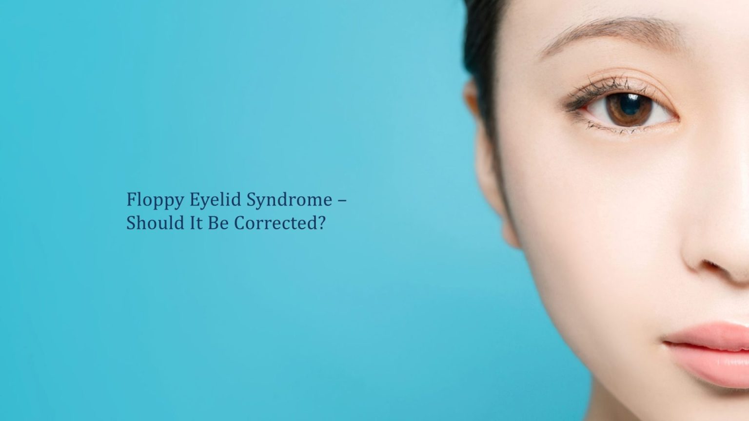 Floppy Eyelid Syndrome in Singapore - Should It Be Corrected?