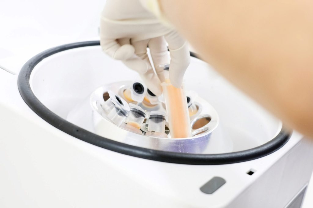 Facial Fat Grafting in Singapore | Dream Plastic Surgery