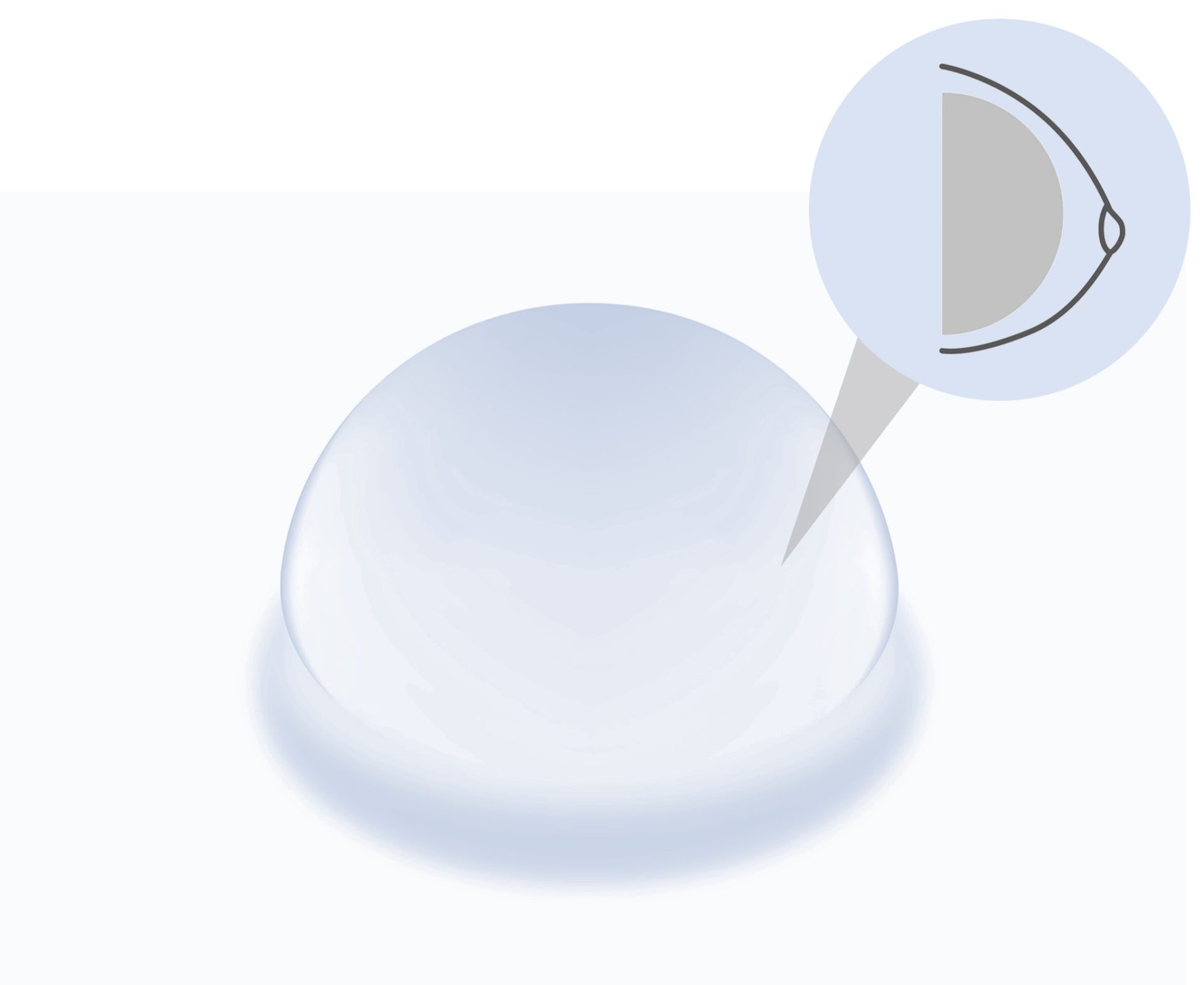 Breast Augmentation & Implants Surgery in Singapore | Dream Aesthetics