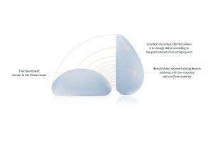 Frequently Asked Questions About Motiva® Implants | Dream Plastic Surgery