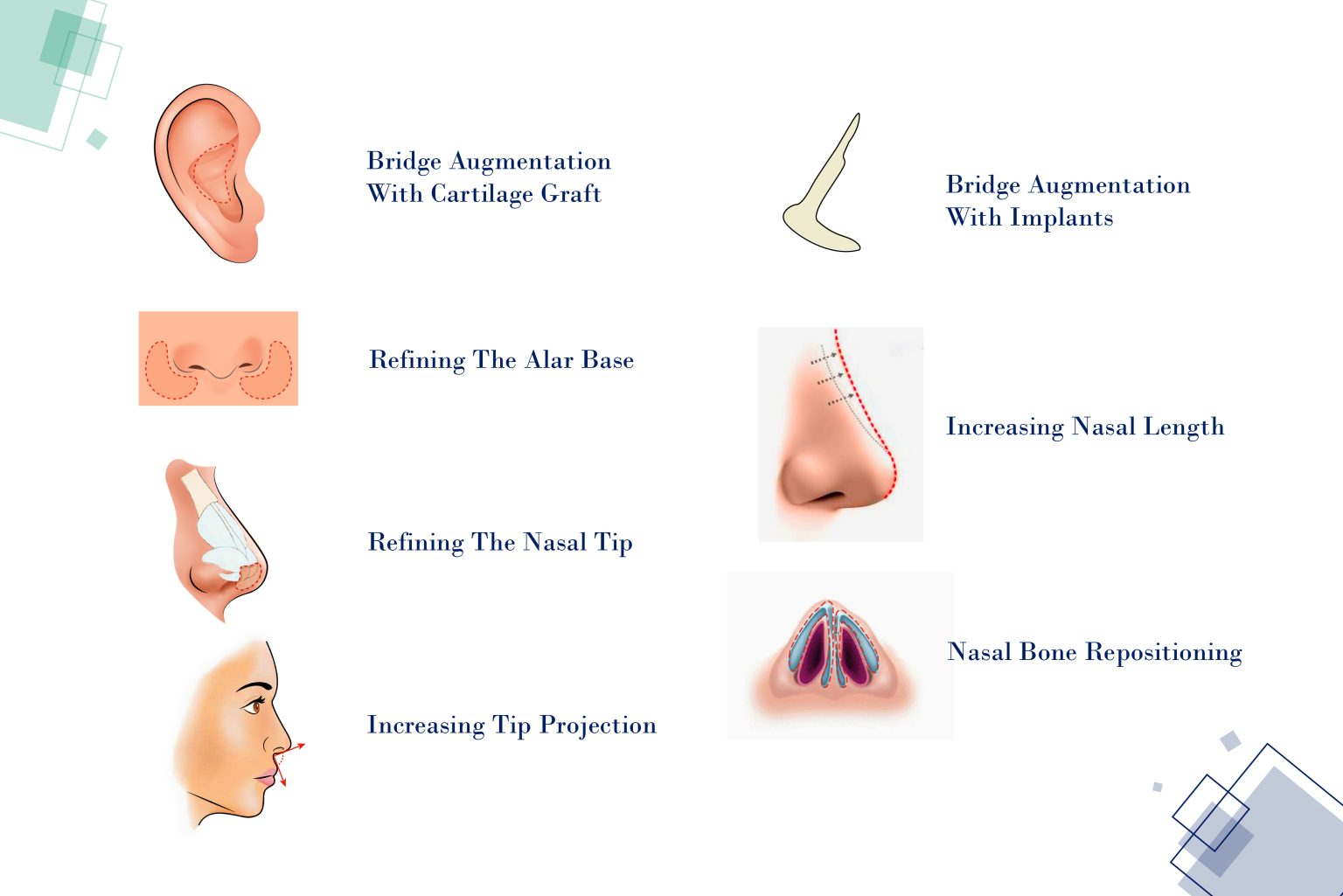 Achieve Your Desirable Nose Shape With Korean Rhinoplasty | Dream ...